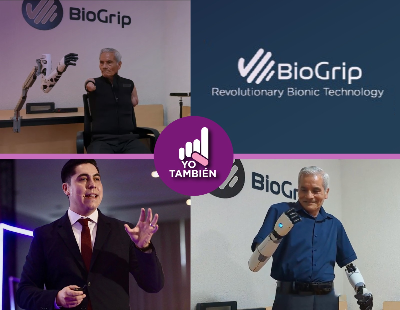 Empresa mexicana que crea prótesis recibirá apoyo de programa de ...